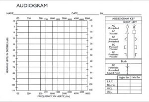 Audiogram – The best tool to understand your hearing – Meenakshi ...