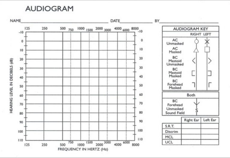 Audiogram – The best tool to understand your hearing – Meenakshi ...